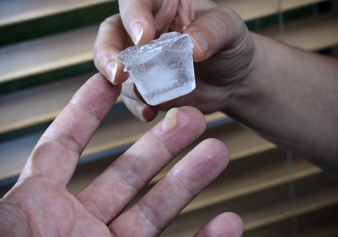 Prevent Ice Burn When Treating Injury | OvertimeReviews